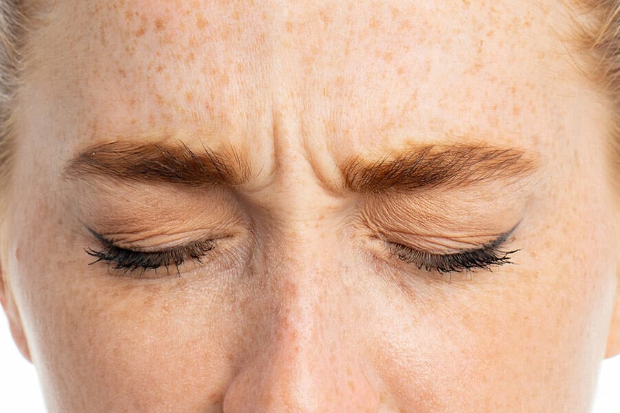 Frown Lines | Allura Skin, Laser & Wellness Clinic | Fort Collins ...