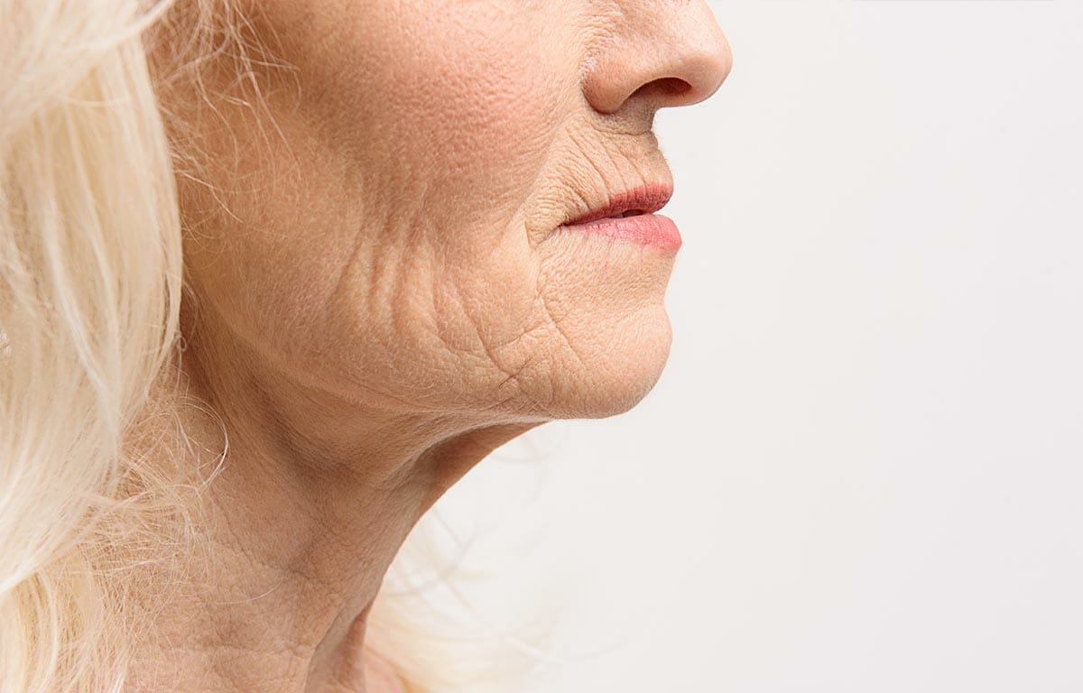 Turkey Neck | Allura Skin, Laser & Wellness Clinic | Fort Collins ...